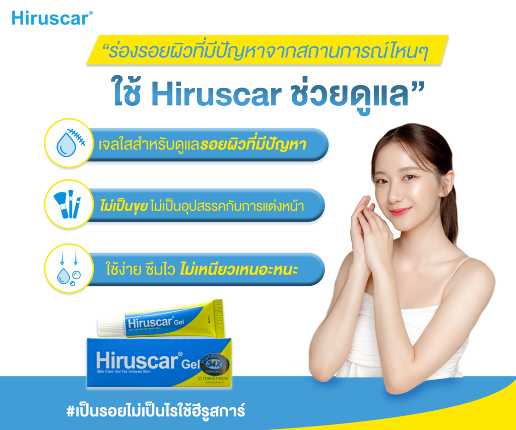 ครีมทารอยแผลเป็นใช้ได้ทุกส่วนของร่างกาย - Hiruscar Thailand